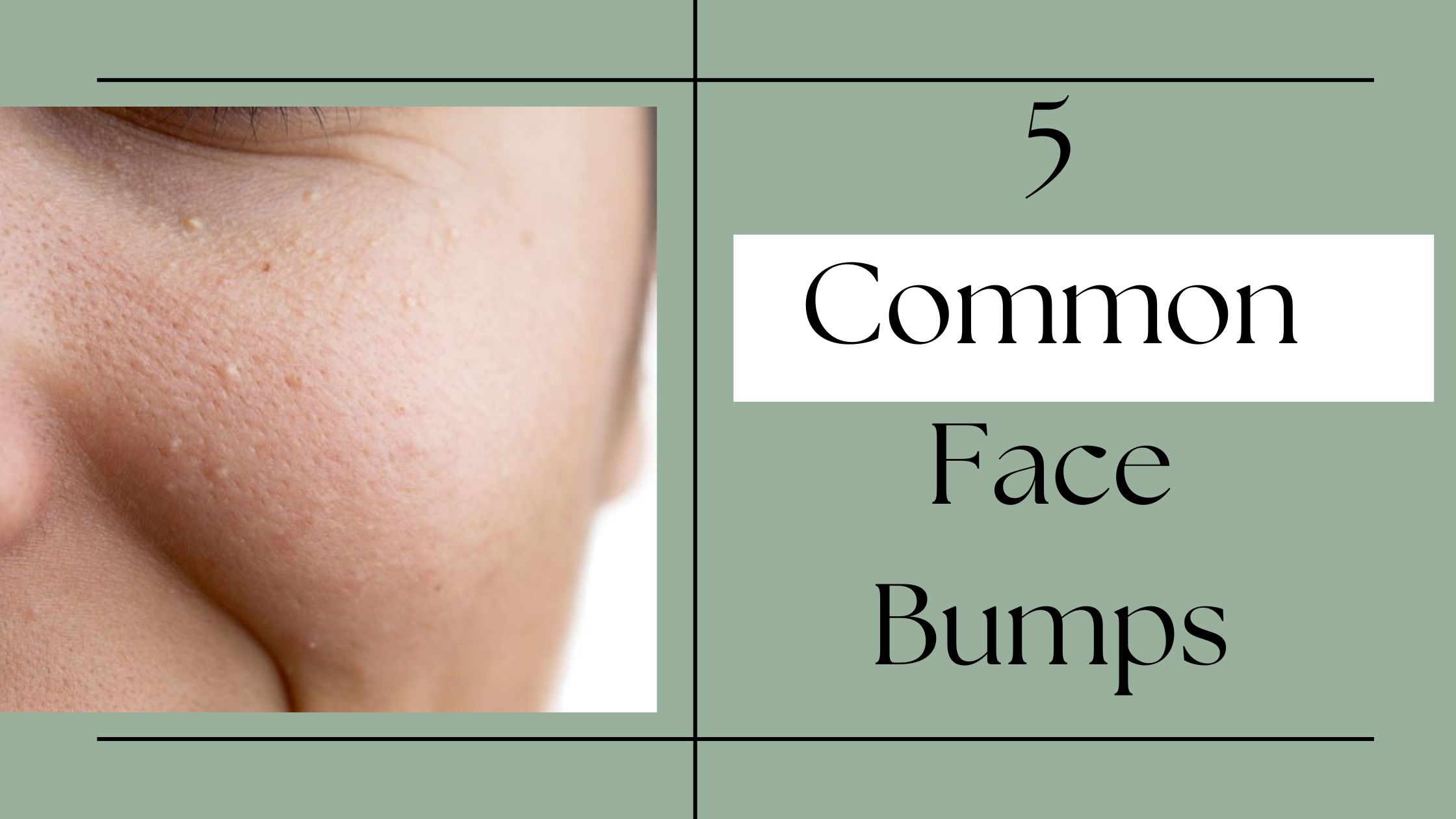 5 Common Face Bumps And How To Deal With Them Flawlessly Fittobeat